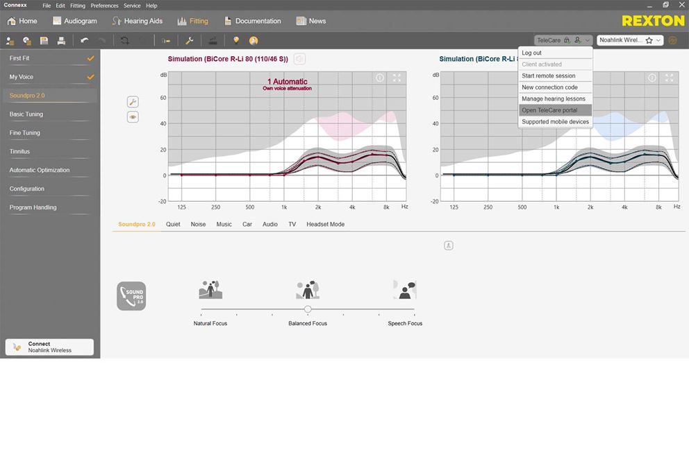 Connexx - fitting software for Rexton hearing aids | Rexton